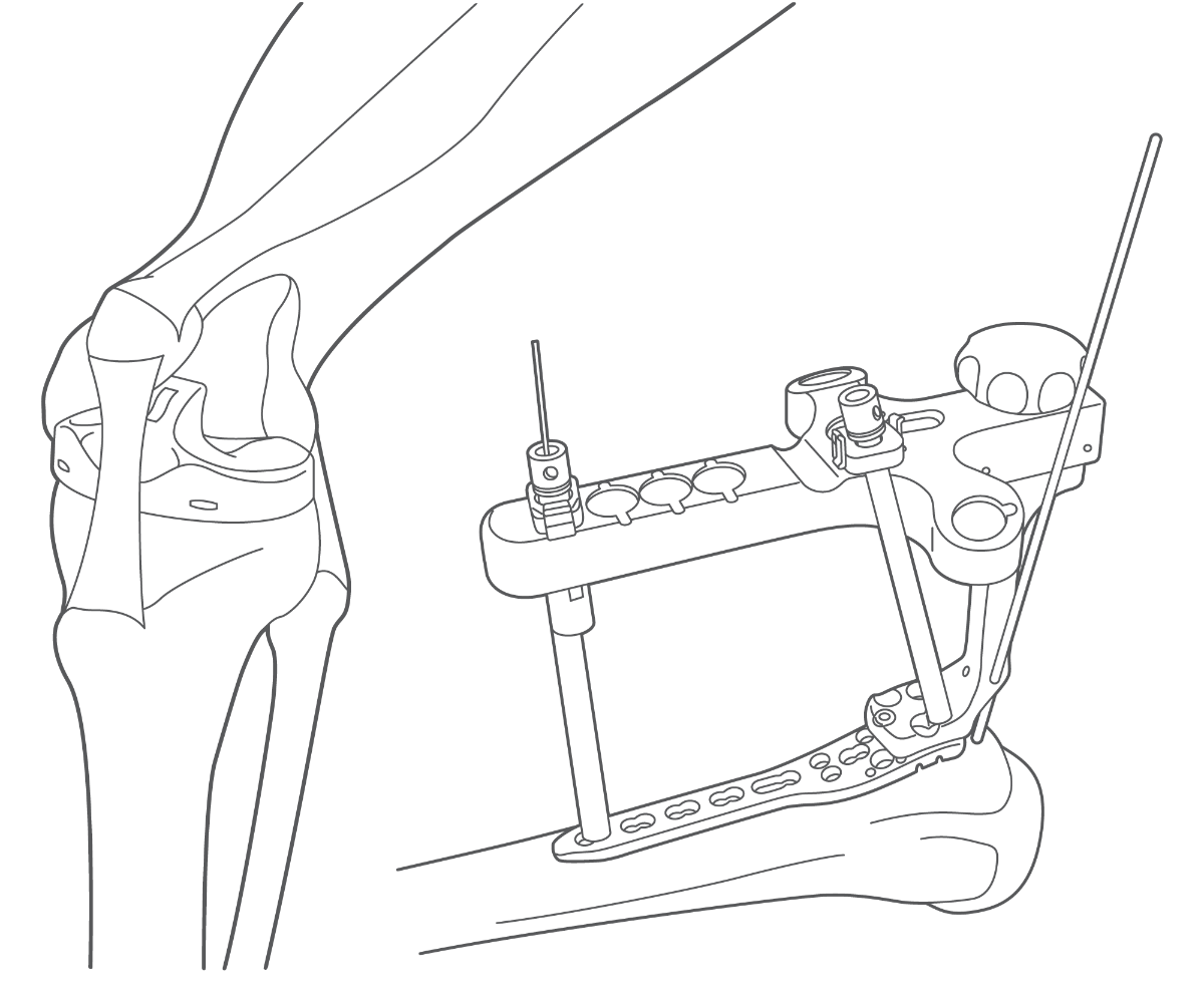 Orthopedics | Jabil