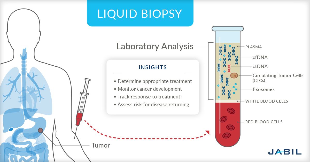 What is Liquid Biopsy? Precision Medicine's Tool of the Future. | Jabil